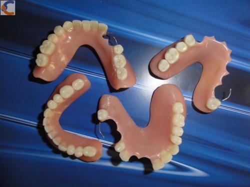 Reparatii proteze dentare acrilice - programari non stop - Servicii ...